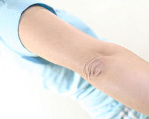 Dry elbows remedy with olive oil moisturizer